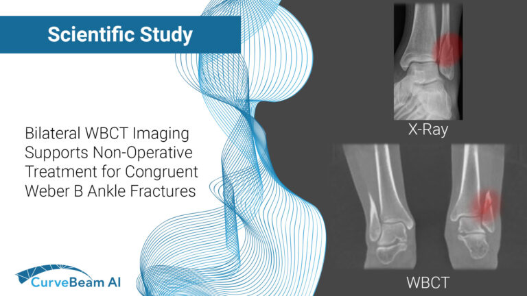 Congruent Weber-B Ankle Fractures Do Not Alter Tibiotalar Contact ...